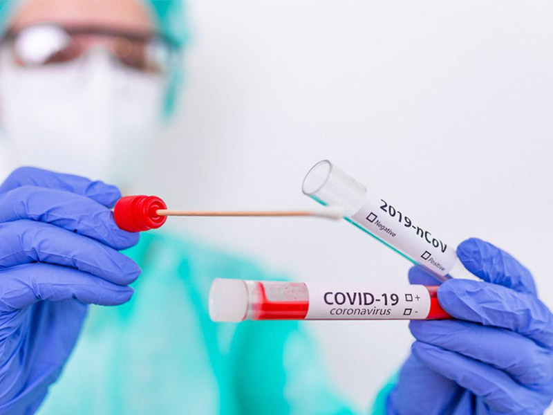 Mengenal Tes Swab dan Prosedurnya - Majalah Inspiratif